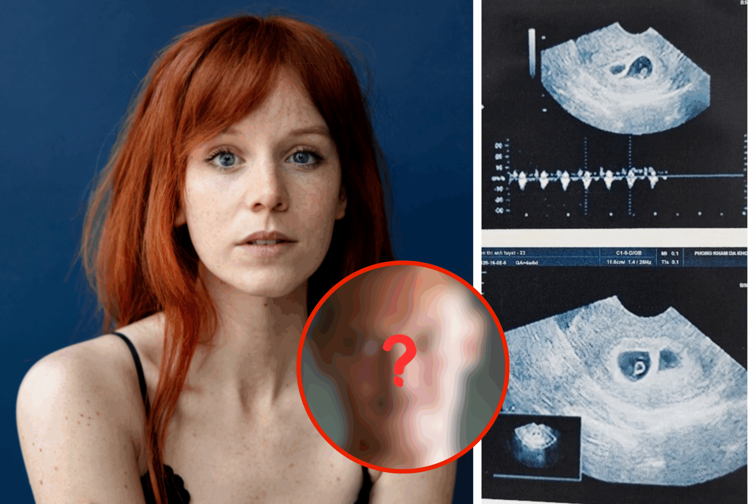 Schokkend nieuws: Jolijn Henneman zwanger van co-ster tijdens GTST ...